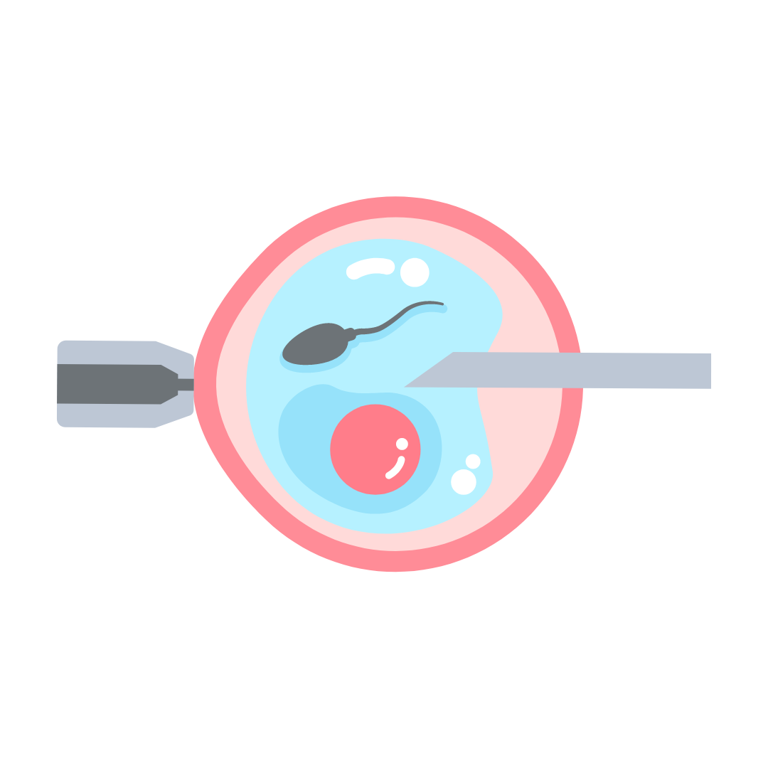 ICSI: Cos'è e perché ha migliori percentuali di successo | IVFforYOU